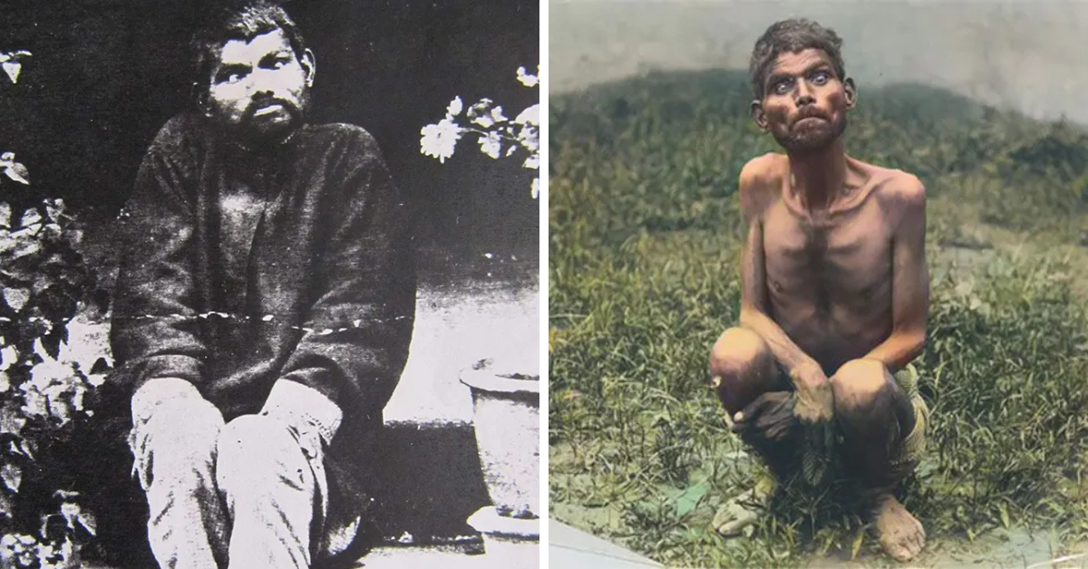 Dina Sanichar: The Real-Life Feral Boy Raised by Wolves Who May Have ...